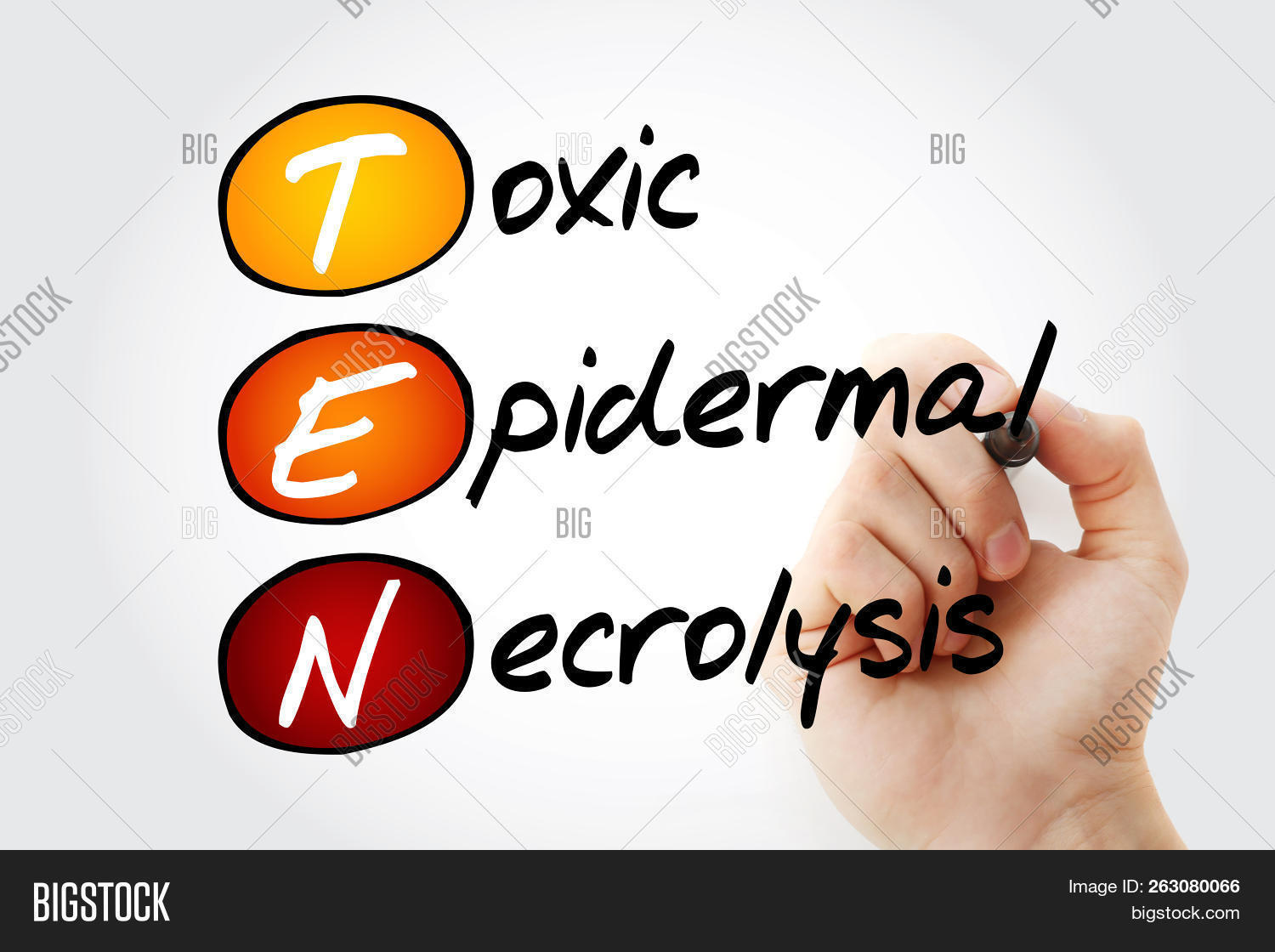 Ten - Toxic Epidermal Image & Photo (Free Trial) | Bigstock