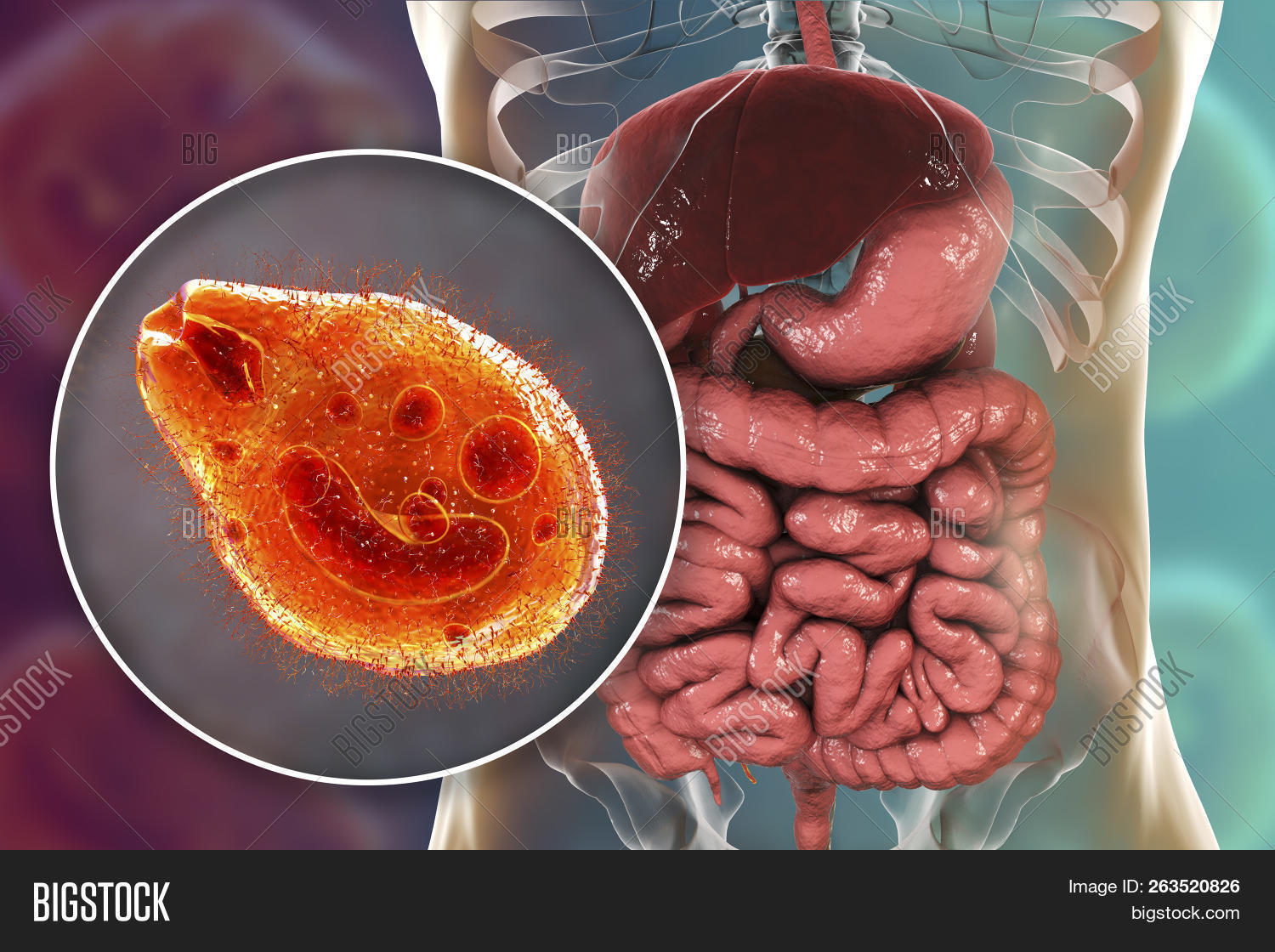 Balantidium Coli Image & Photo (Free Trial) | Bigstock