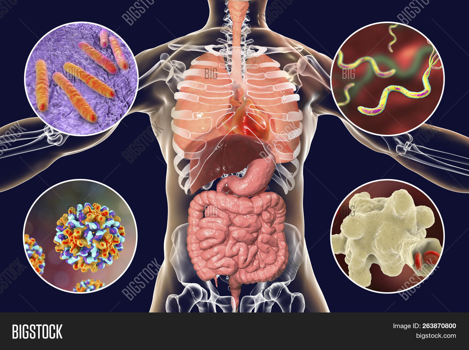 Human Pathogenic Image & Photo (Free Trial) | Bigstock