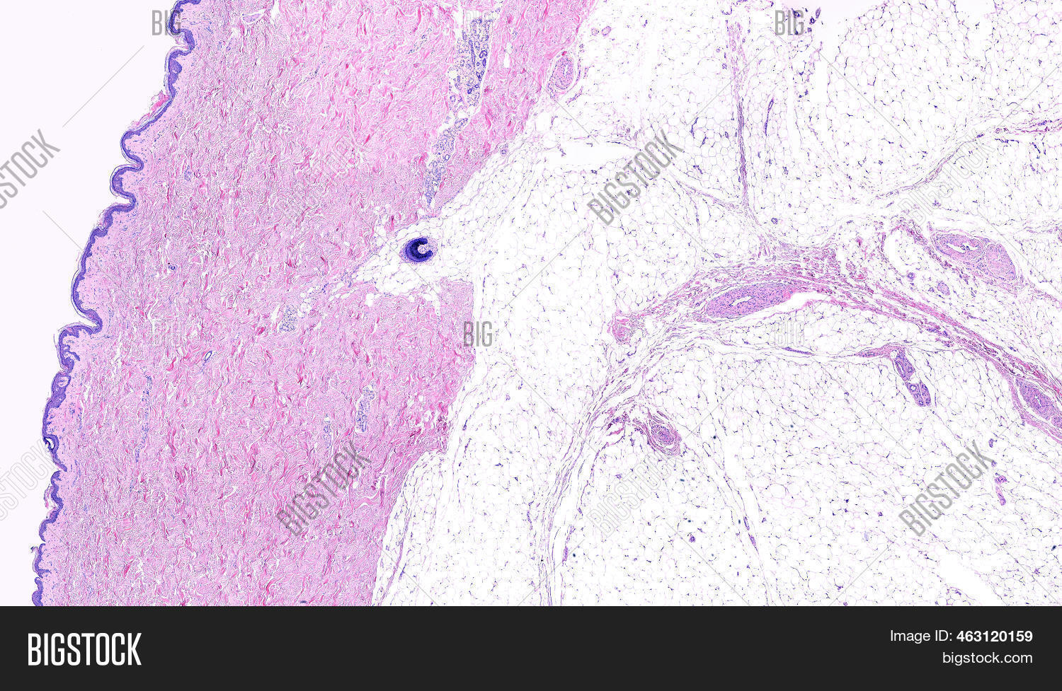 Low Power Light Image & Photo (Free Trial) | Bigstock