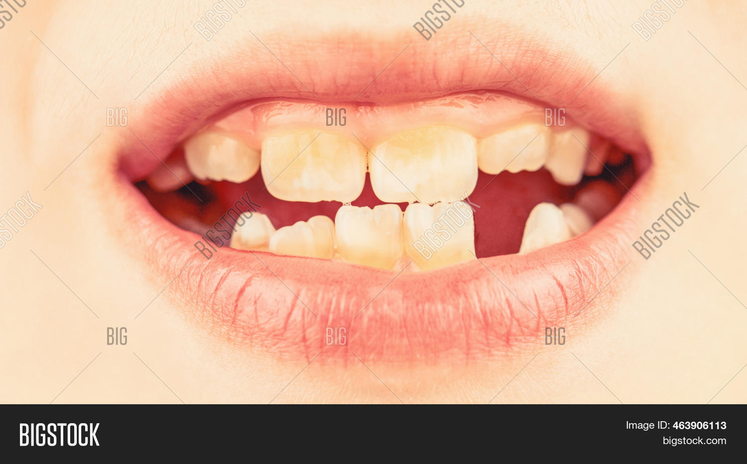 Child Smile Show Her Image & Photo (Free Trial) | Bigstock