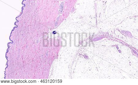 Low Power Light Image & Photo (Free Trial) | Bigstock