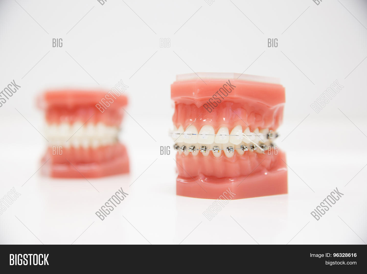 Model Human Jaw Wire Image & Photo (Free Trial) | Bigstock