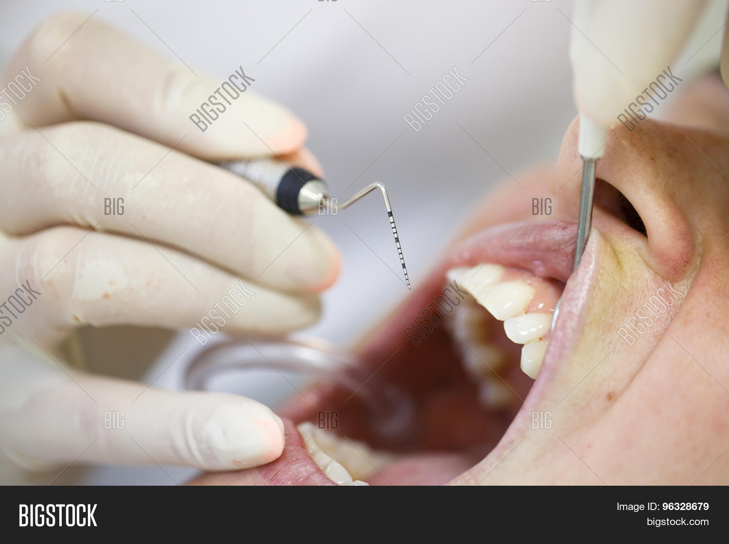 Periodontal Probe Image & Photo (Free Trial) | Bigstock