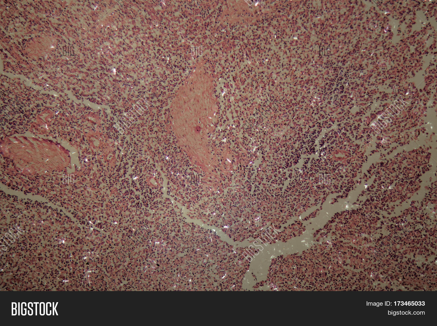 Cells Human Ovary Image & Photo (Free Trial) | Bigstock