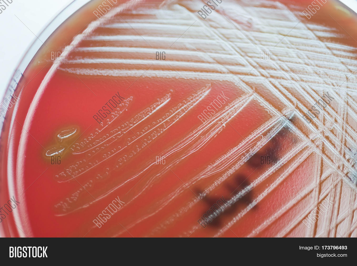 Streptococcus Suis; Image & Photo (Free Trial) | Bigstock
