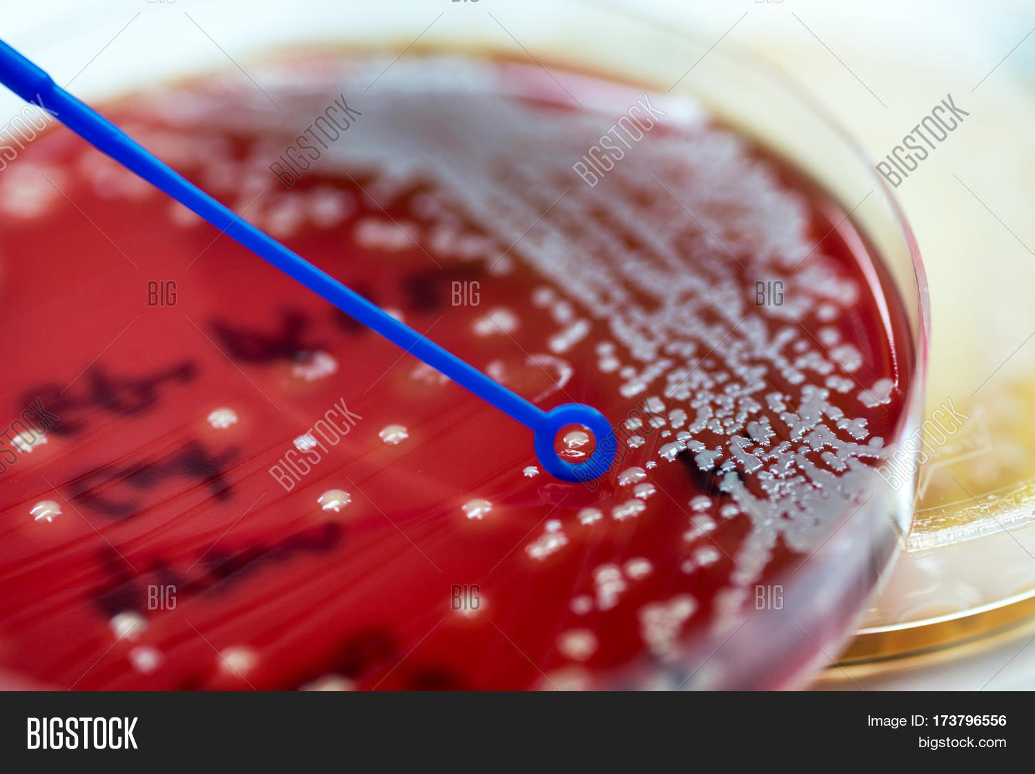 Loop Exposure Colonies Image & Photo (Free Trial) | Bigstock