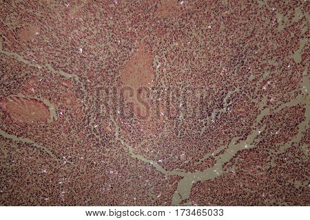 Cells Human Ovary Image & Photo (Free Trial) | Bigstock