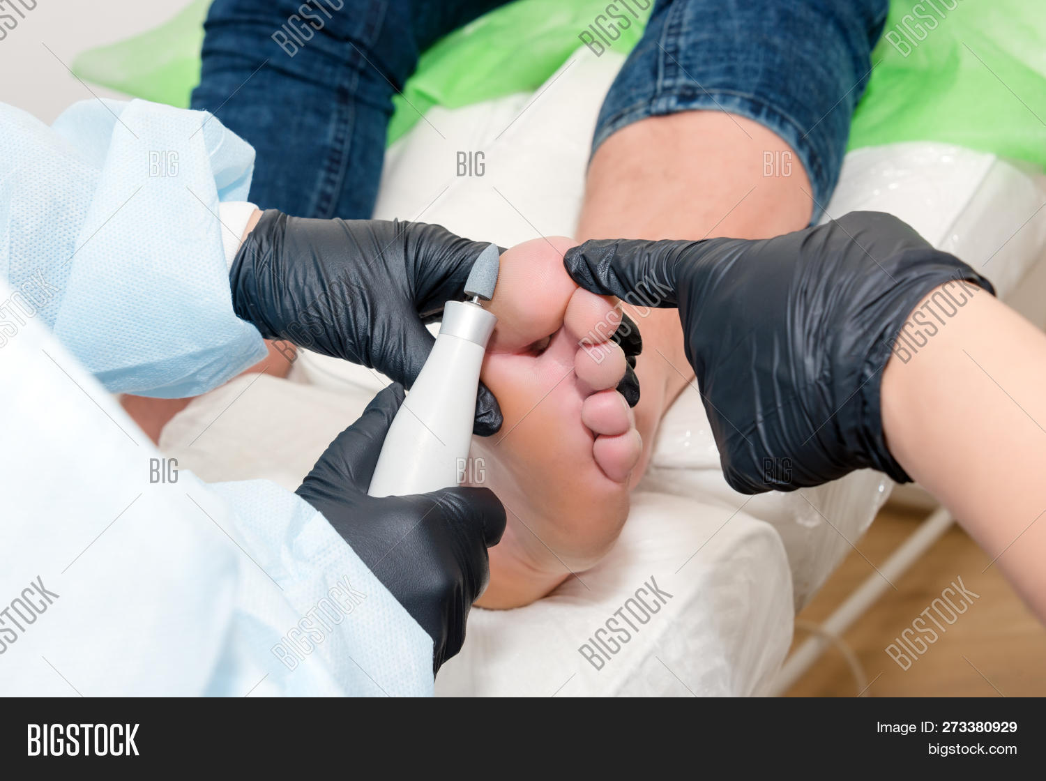 Podology Treatment. Image & Photo (Free Trial) | Bigstock