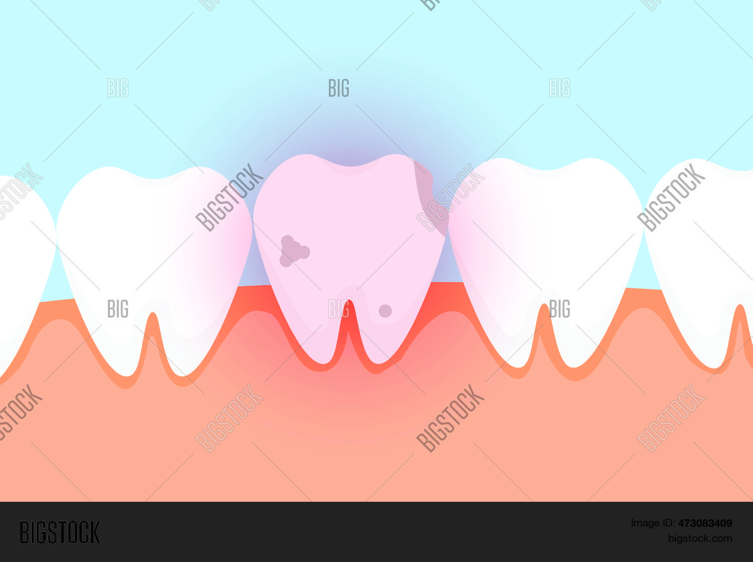 Bad Tooth Hurting Red Vector & Photo (Free Trial) | Bigstock
