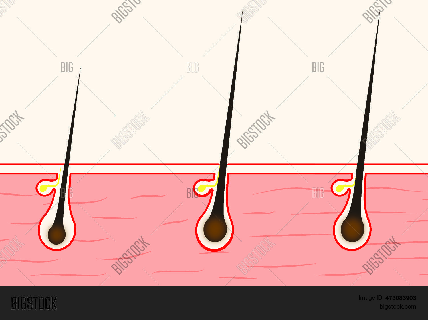 Hair Growing Concept Vector & Photo (Free Trial) | Bigstock