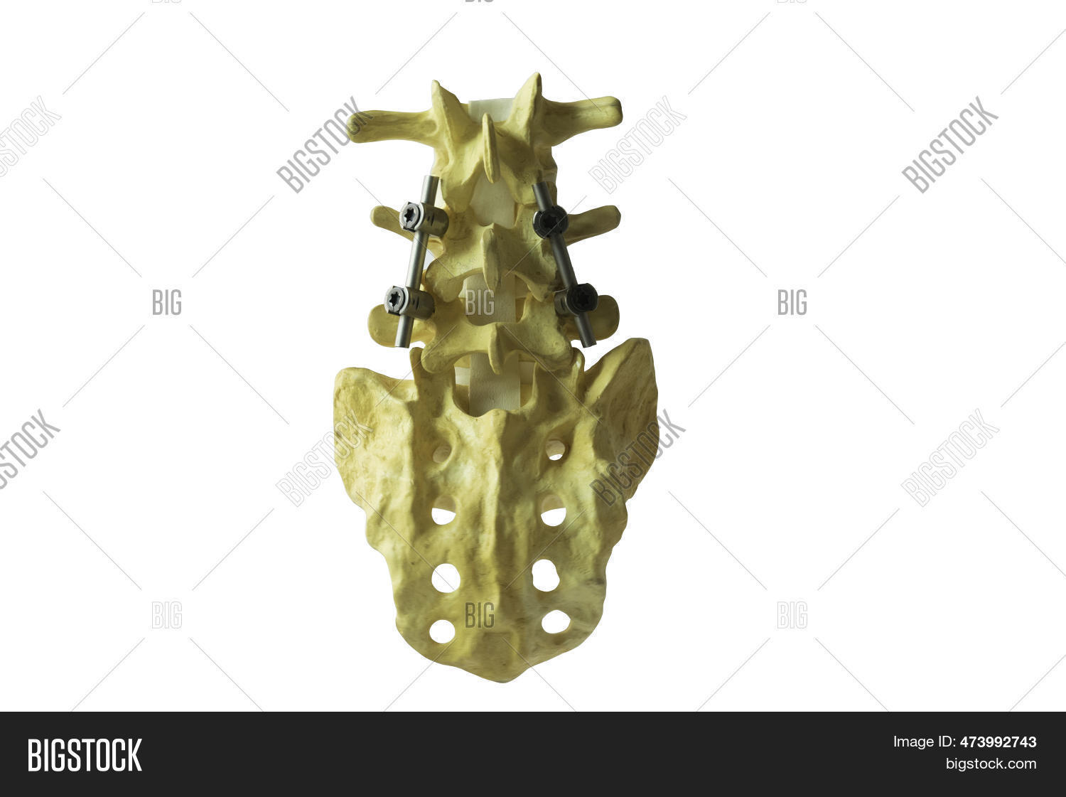 Lumbra Spine Model Rod Image & Photo (Free Trial) | Bigstock