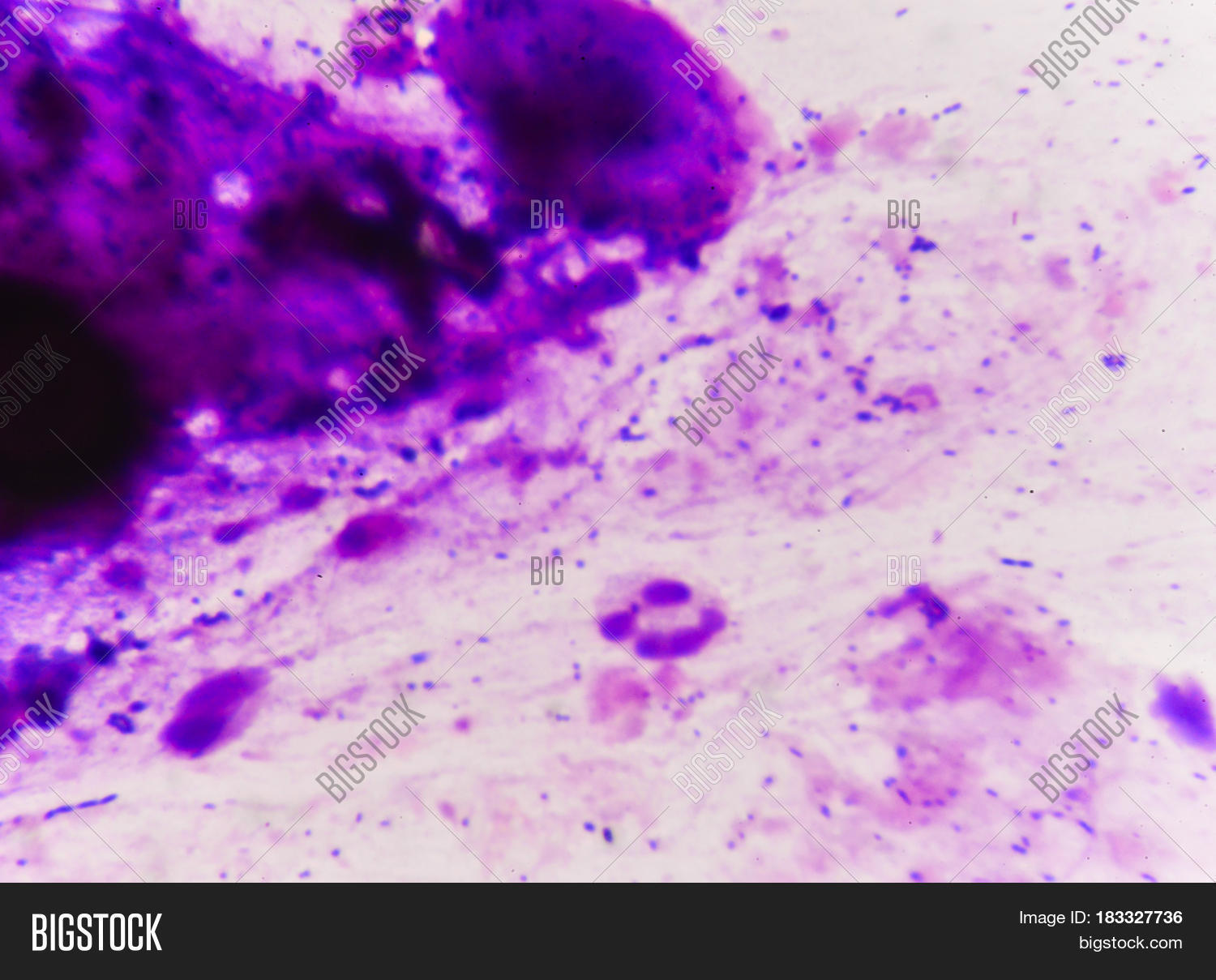 Gram Staining, Called Image & Photo (Free Trial) | Bigstock