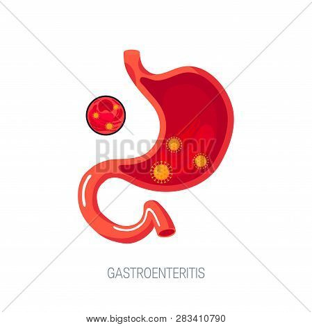 Gastroenteritis Vector & Photo (Free Trial) | Bigstock