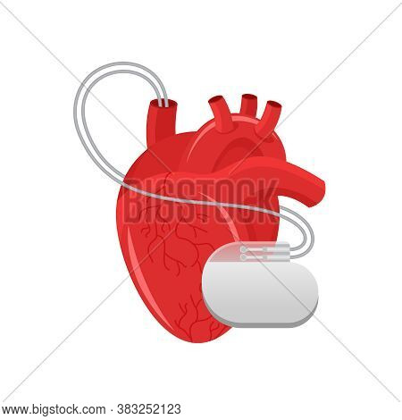 Pacemaker Vector & Photo (Free Trial) | Bigstock