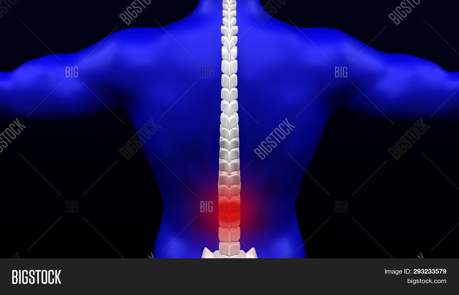 Lower Back Pain. Red Image & Photo (Free Trial) | Bigstock