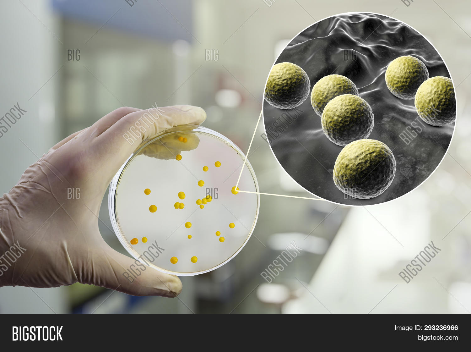 Colonies Micrococcus Image & Photo (Free Trial) | Bigstock