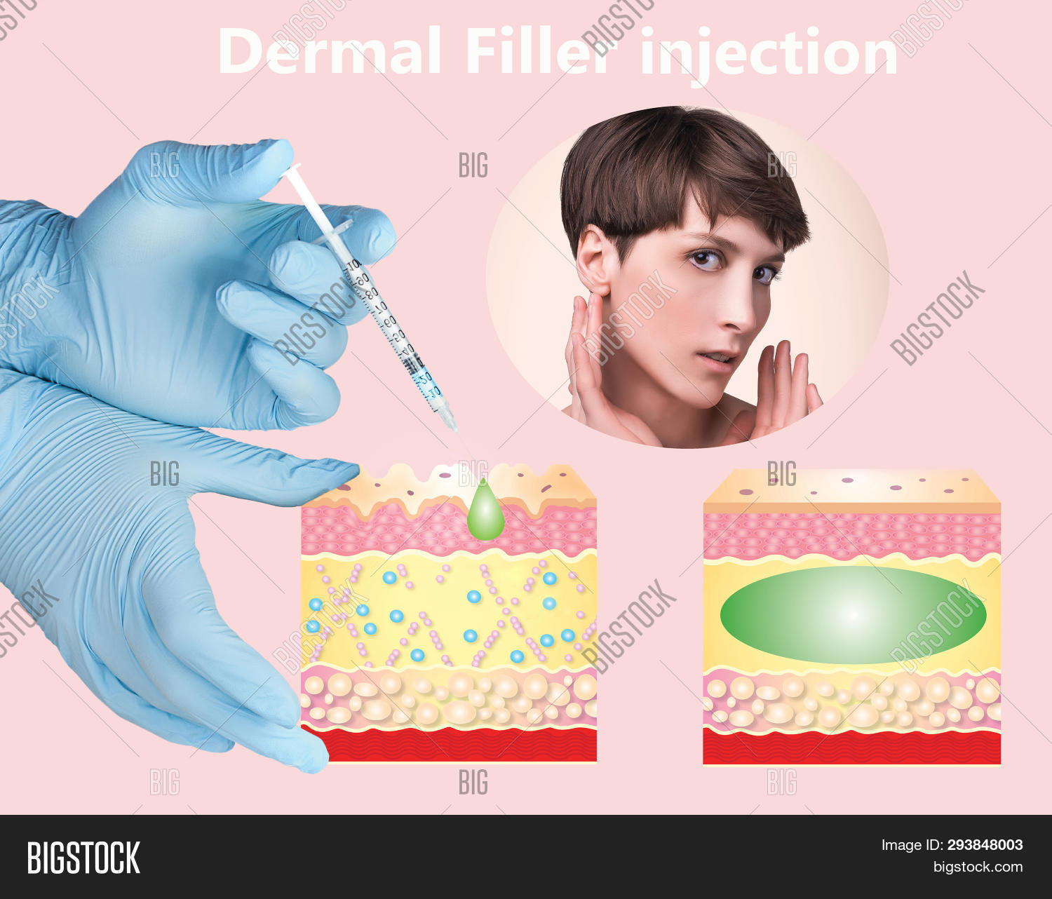 Cosmetic Dermal Image & Photo (Free Trial) | Bigstock