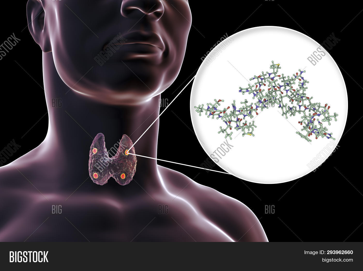 Human Parathyroid Image & Photo (Free Trial) | Bigstock