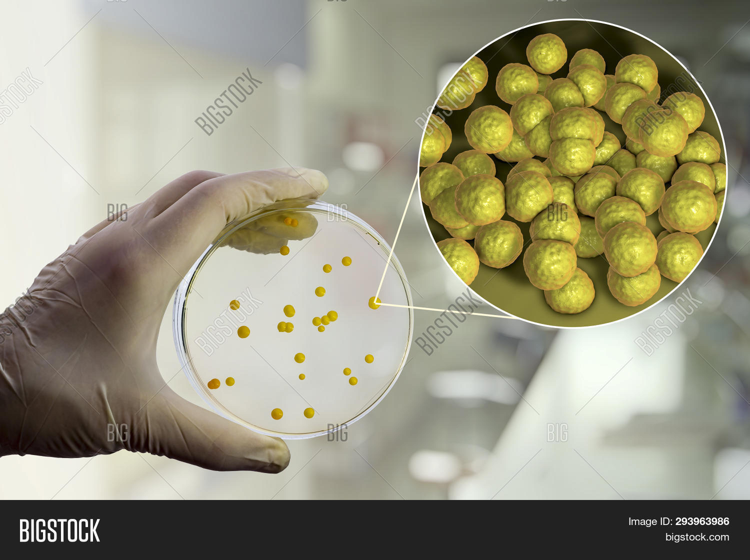 Colonies Micrococcus Image & Photo (Free Trial) | Bigstock