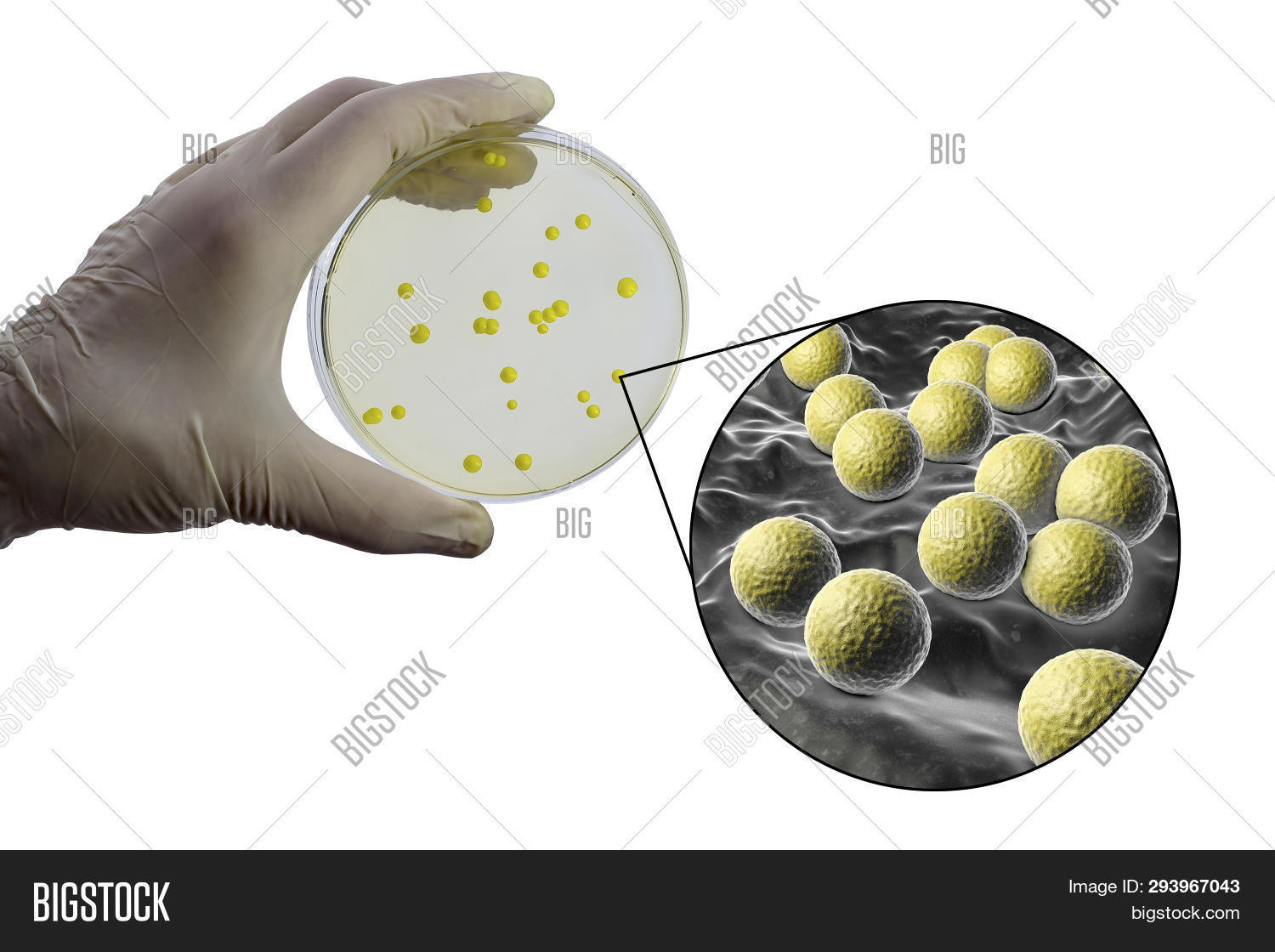 Colonies Micrococcus Image & Photo (Free Trial) | Bigstock
