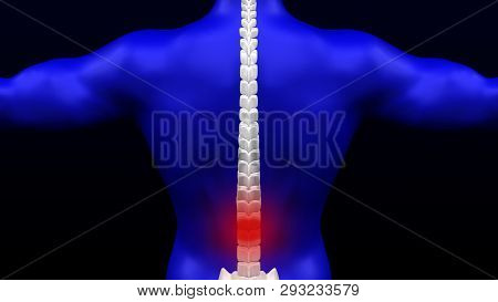 Lower Back Pain. Red Image & Photo (Free Trial) | Bigstock