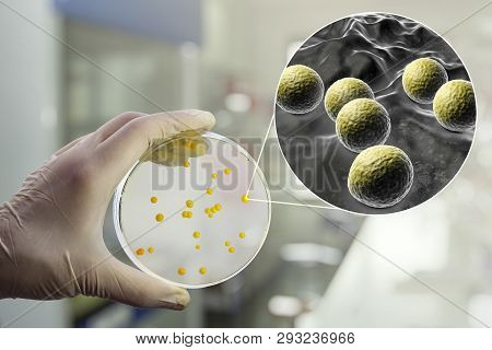 Colonies Micrococcus Image & Photo (Free Trial) | Bigstock