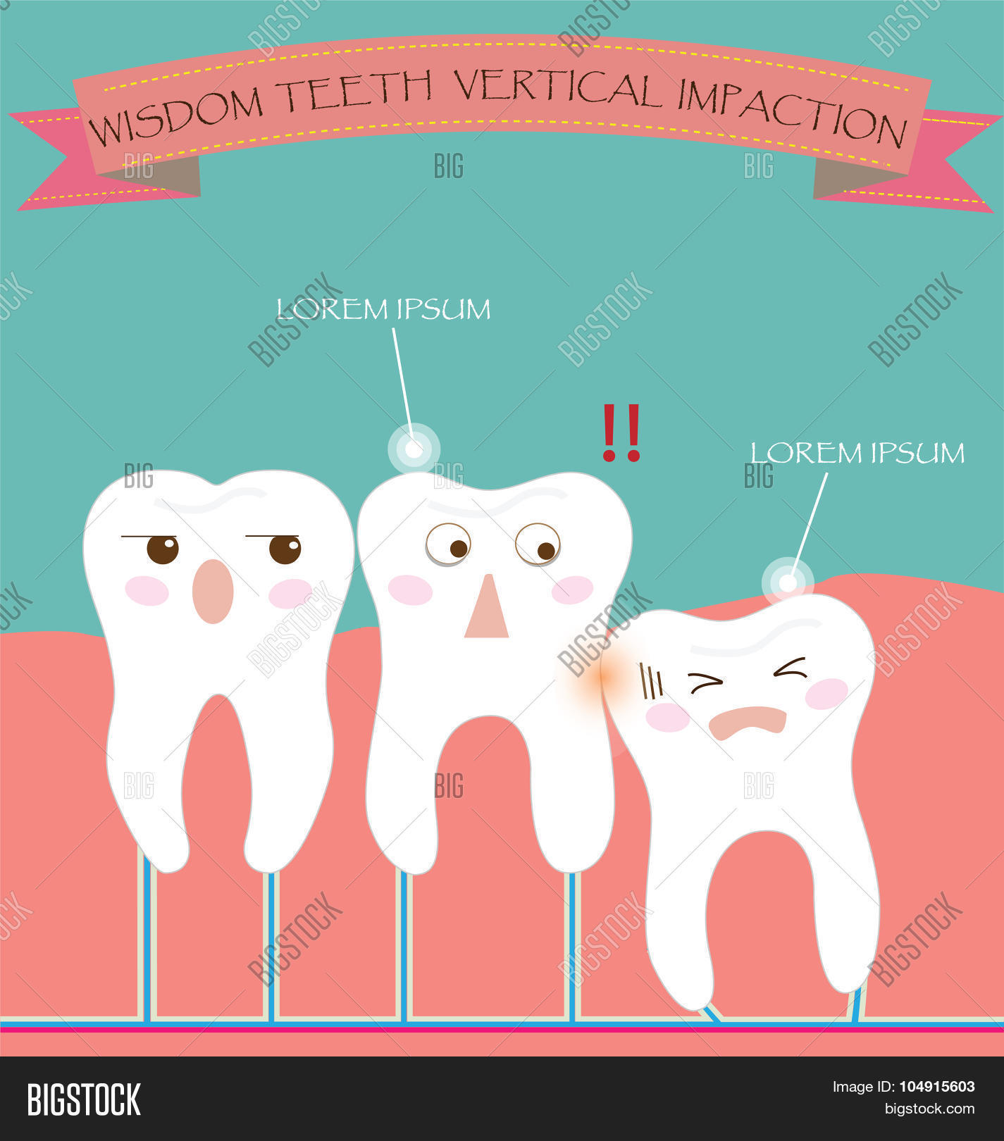 Wisdom Teeth Vertical Vector & Photo (Free Trial) | Bigstock