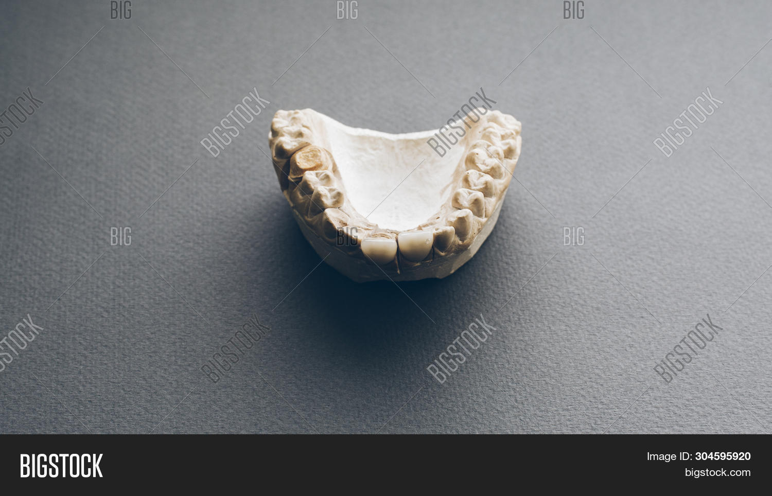Human Jaw Layout Image & Photo (Free Trial) | Bigstock