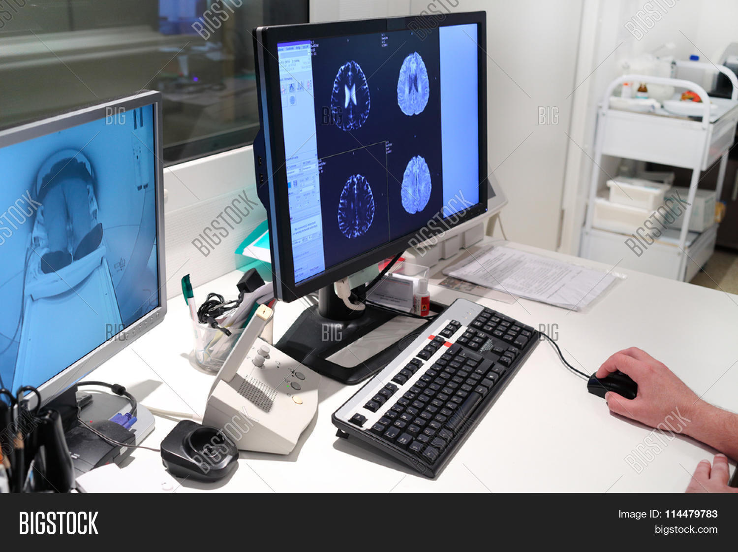 MRI Scan Brain On Image & Photo (Free Trial) | Bigstock