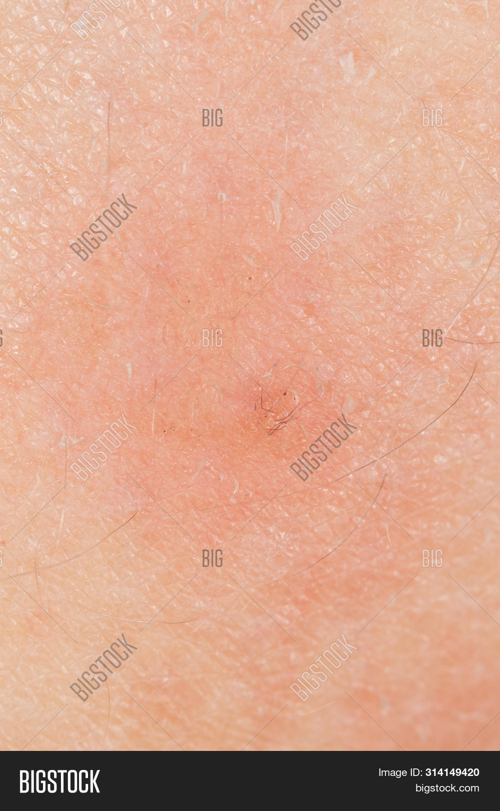 Little Wound On Human Image & Photo (Free Trial) | Bigstock