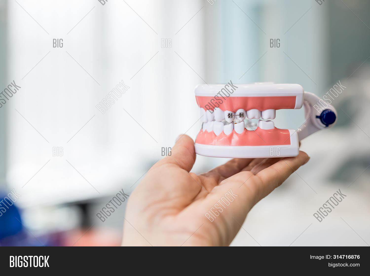 Model Human Jaw Wire Image & Photo (Free Trial) | Bigstock