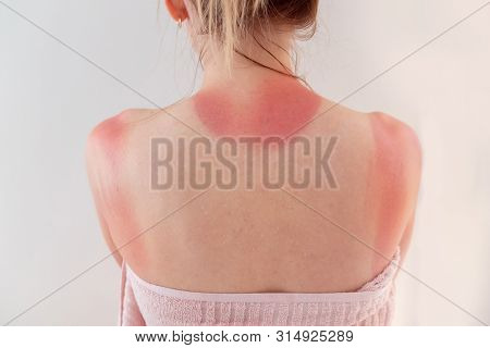 Womans Back Skin Hurt Image & Photo (Free Trial) | Bigstock