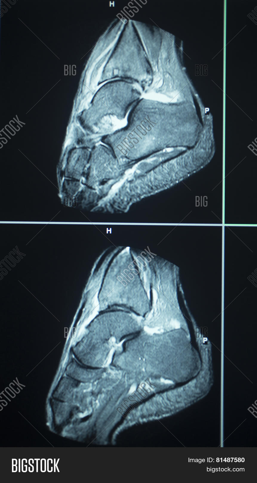 Mri Scan Test Results Image & Photo (Free Trial) | Bigstock