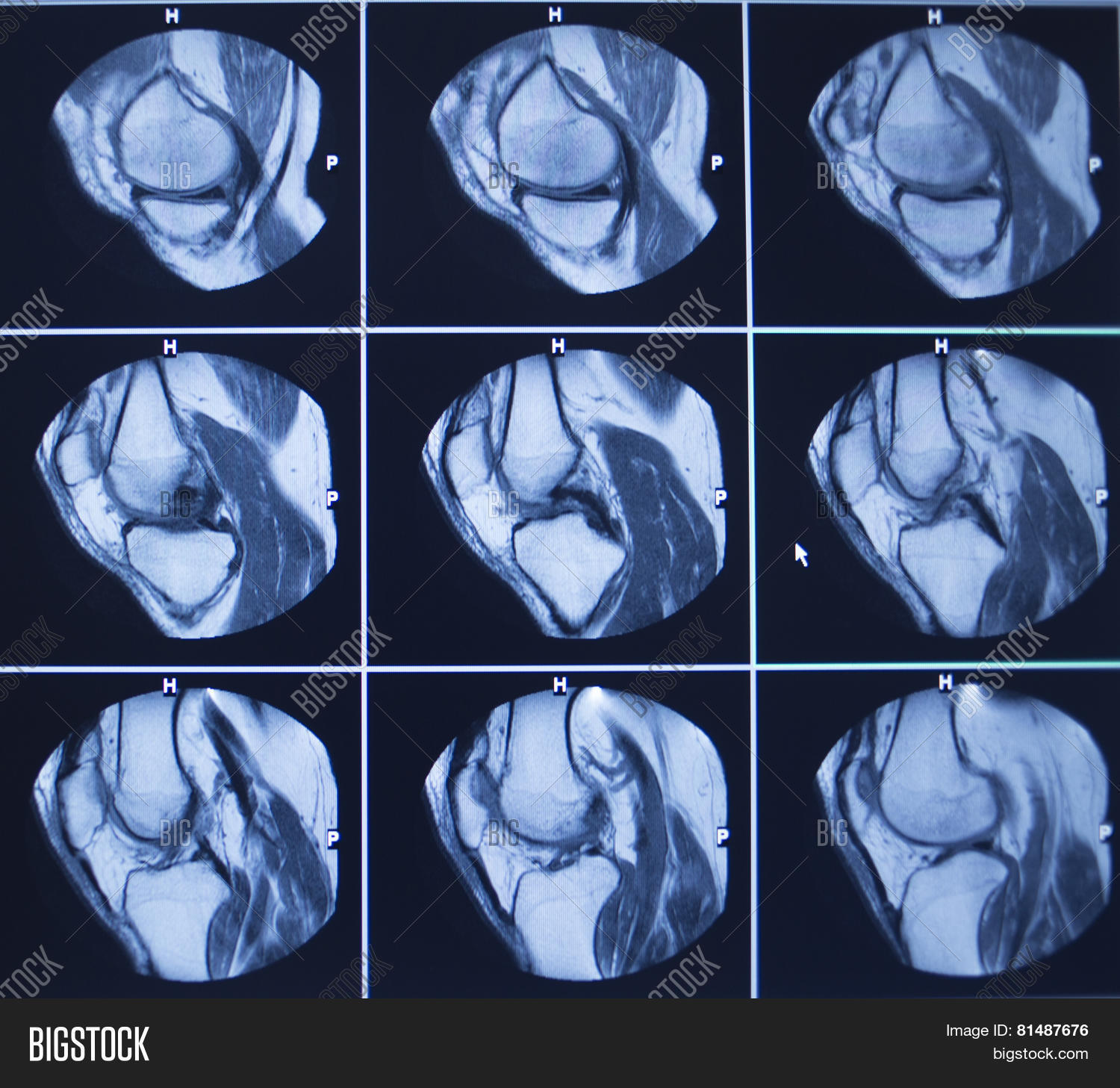 Mri Scan Test Results Image & Photo (Free Trial) | Bigstock