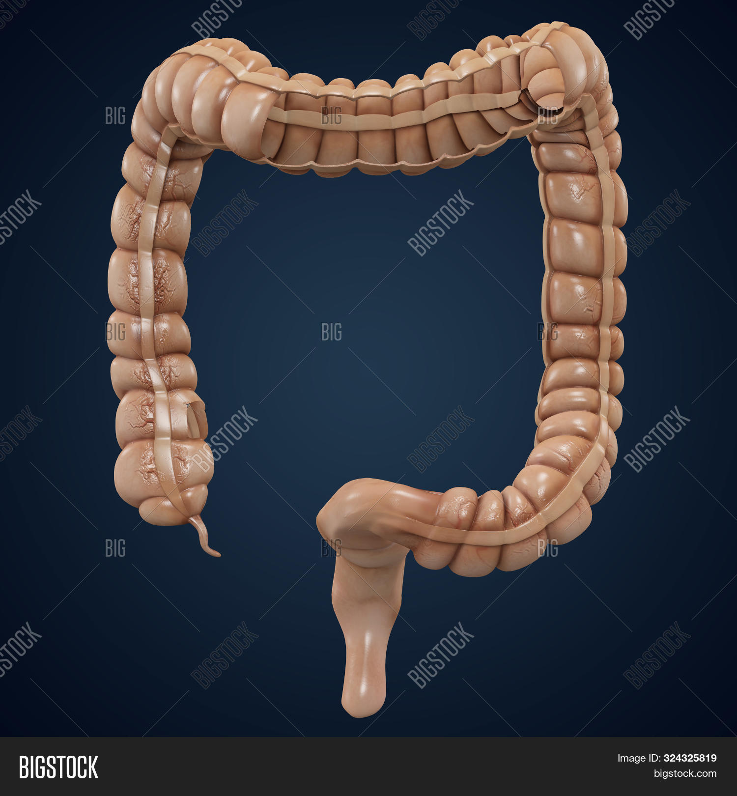 Large Intestine Image & Photo (Free Trial) | Bigstock