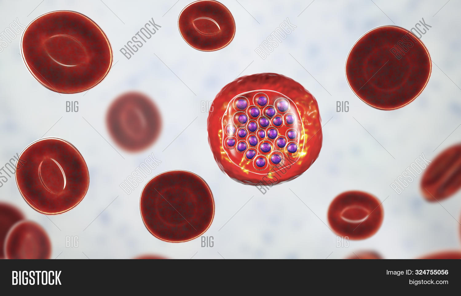 Malaria-infected Red Image & Photo (Free Trial) | Bigstock