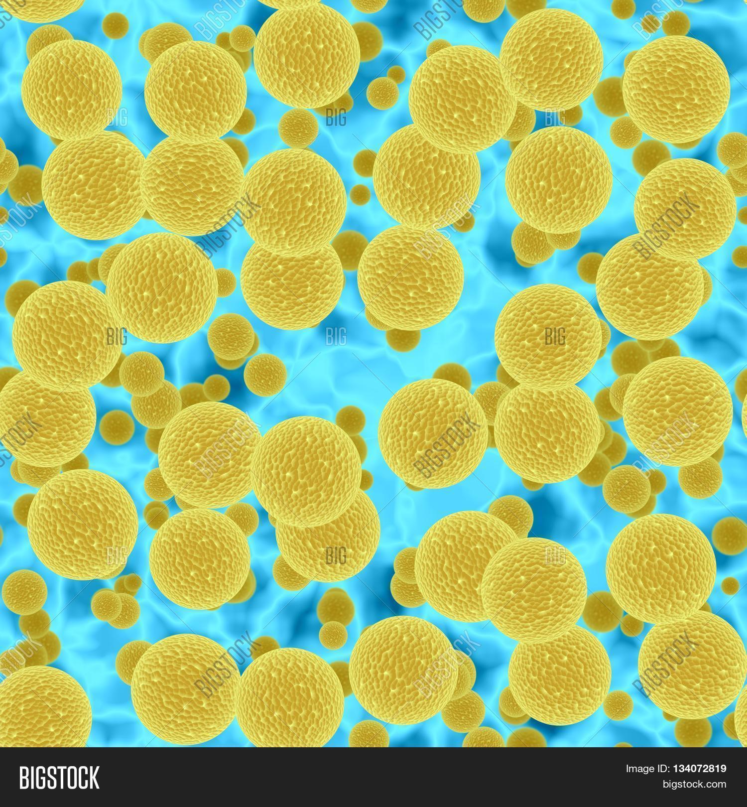 Detail Illness. Yellow Image & Photo (Free Trial) | Bigstock
