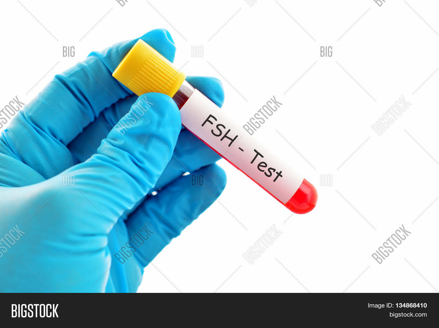 Test Tube Blood Sample Image & Photo (Free Trial) | Bigstock