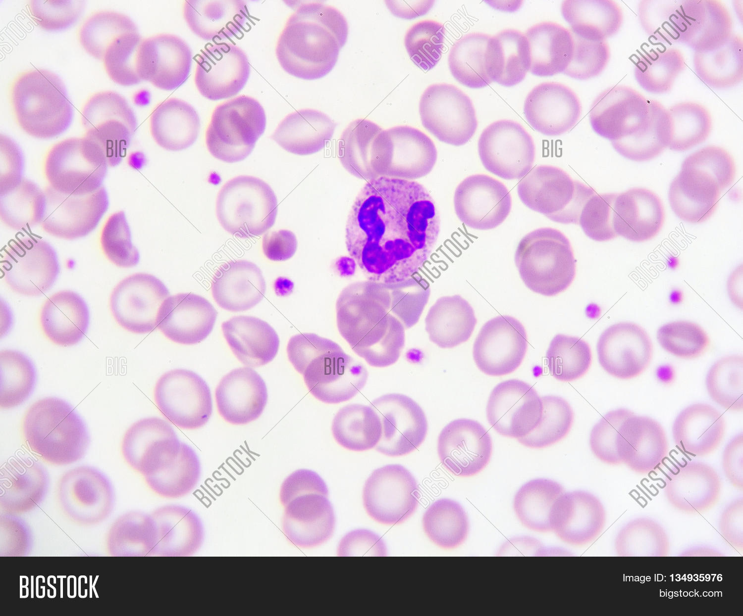 Neutrophil Cell (white Image & Photo (Free Trial) | Bigstock