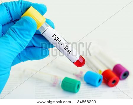 Test Tube Blood Sample Image & Photo (Free Trial) | Bigstock