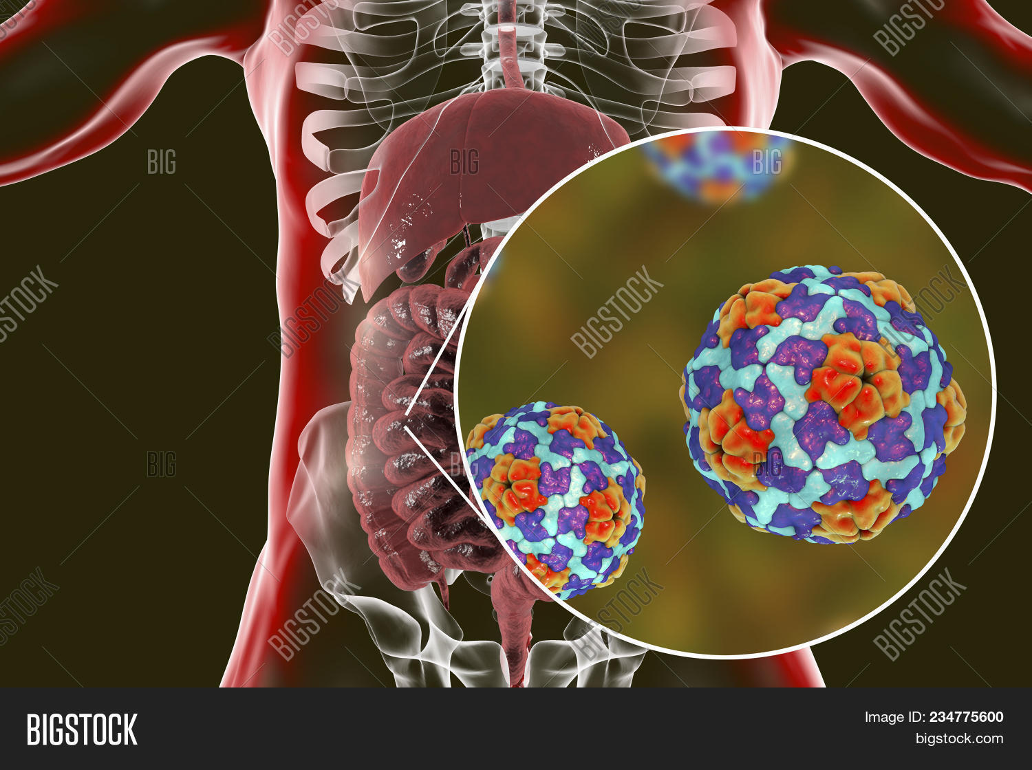 Hepatitis Viruses Hav Image & Photo (Free Trial) | Bigstock