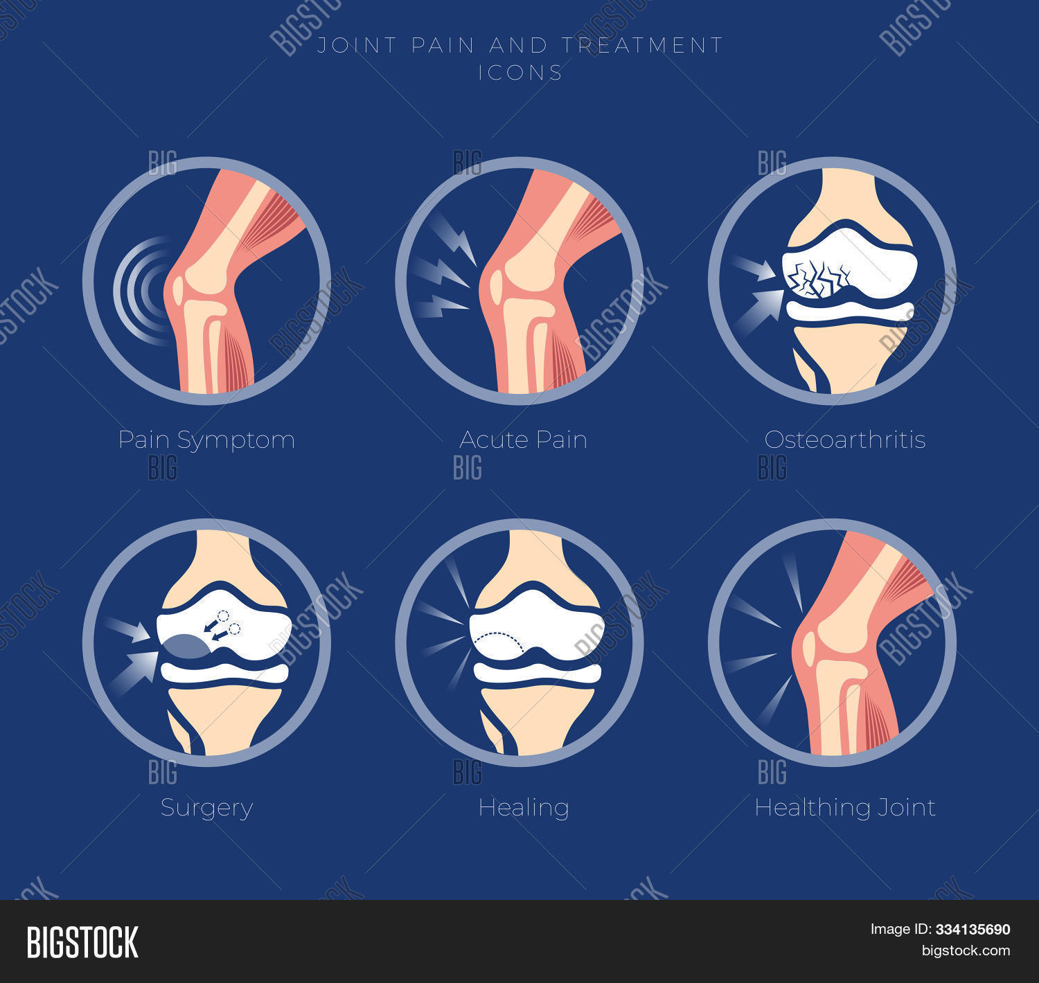 Set Icons Joints Vector & Photo (Free Trial) | Bigstock