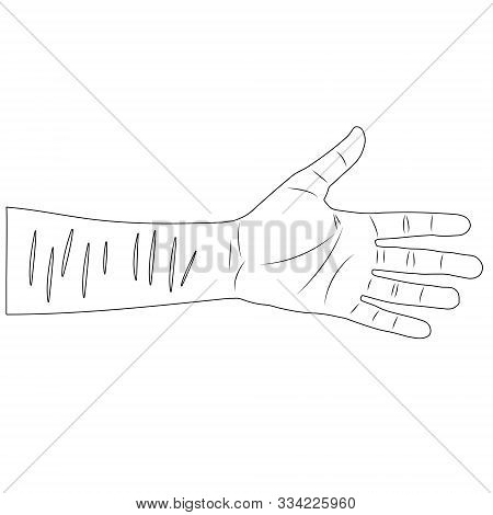 Man Hand Scars On Vector & Photo (Free Trial) | Bigstock