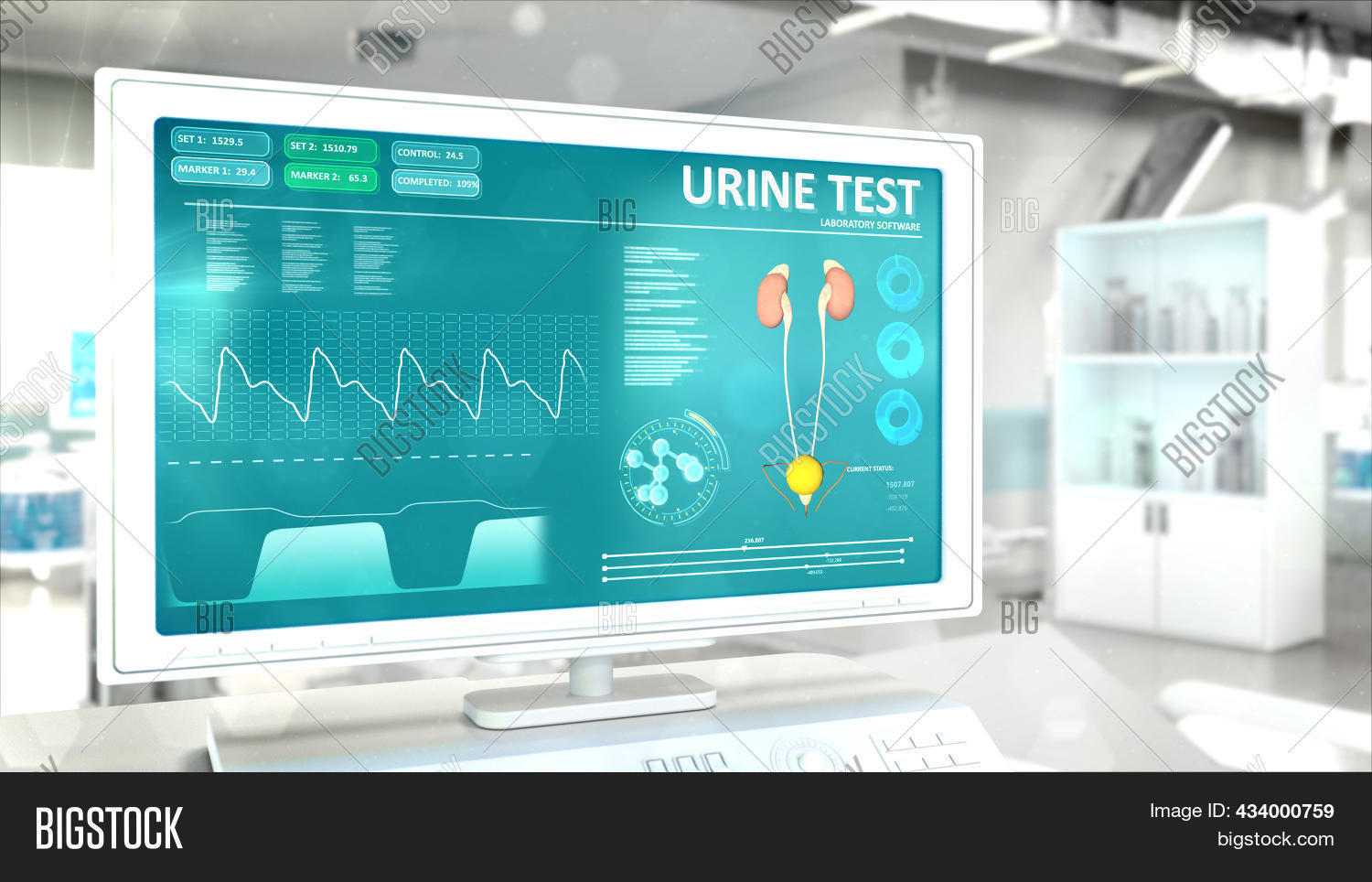 Urinalysis On Monitor Image & Photo (Free Trial) | Bigstock