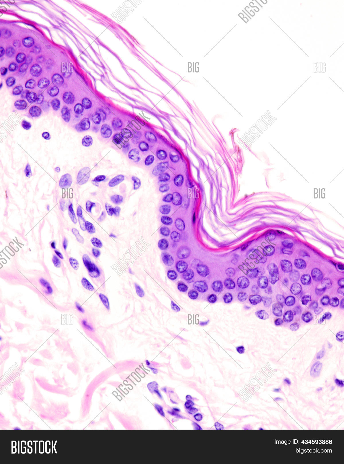 Epidermis Thin Skin Image & Photo (Free Trial) | Bigstock