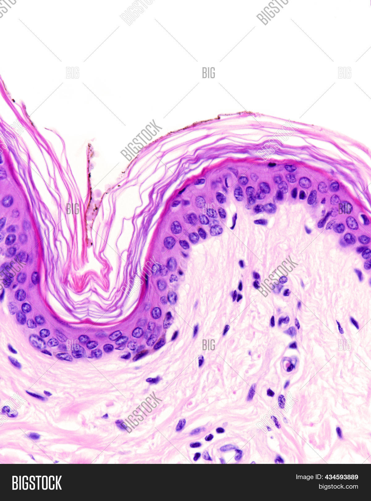 Epidermis Thin Skin Image & Photo (Free Trial) | Bigstock