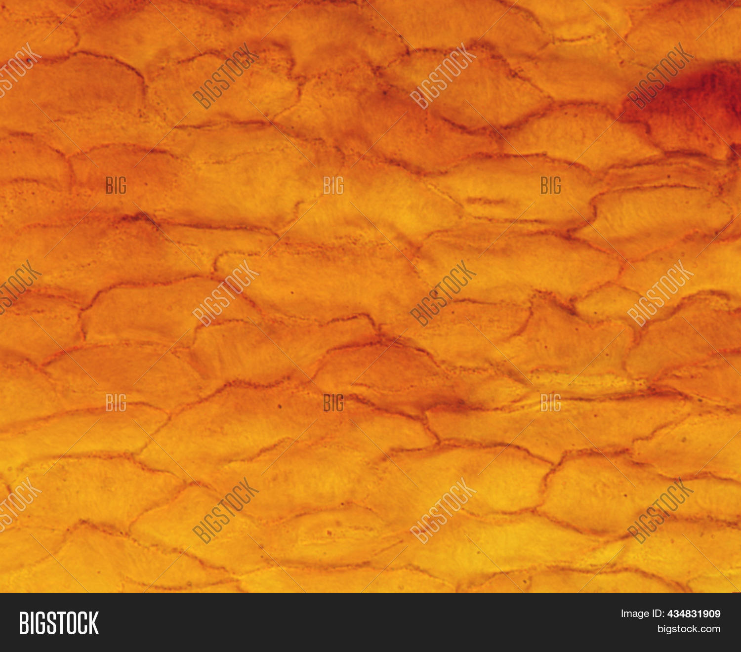 Silver Stain Methods Image & Photo (Free Trial) | Bigstock