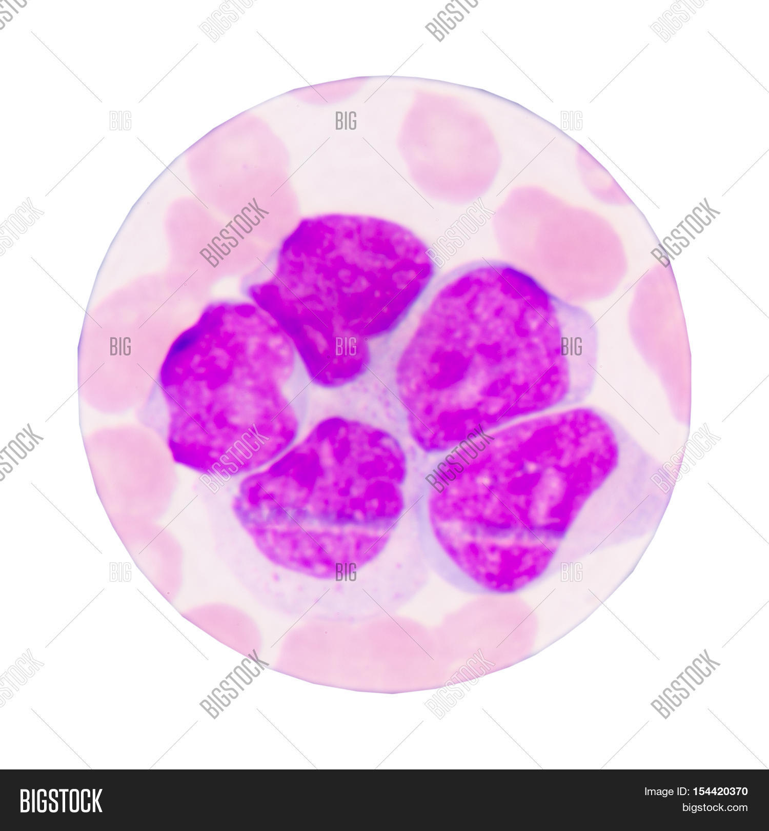 Blast Blood Cells On Image & Photo (Free Trial) | Bigstock