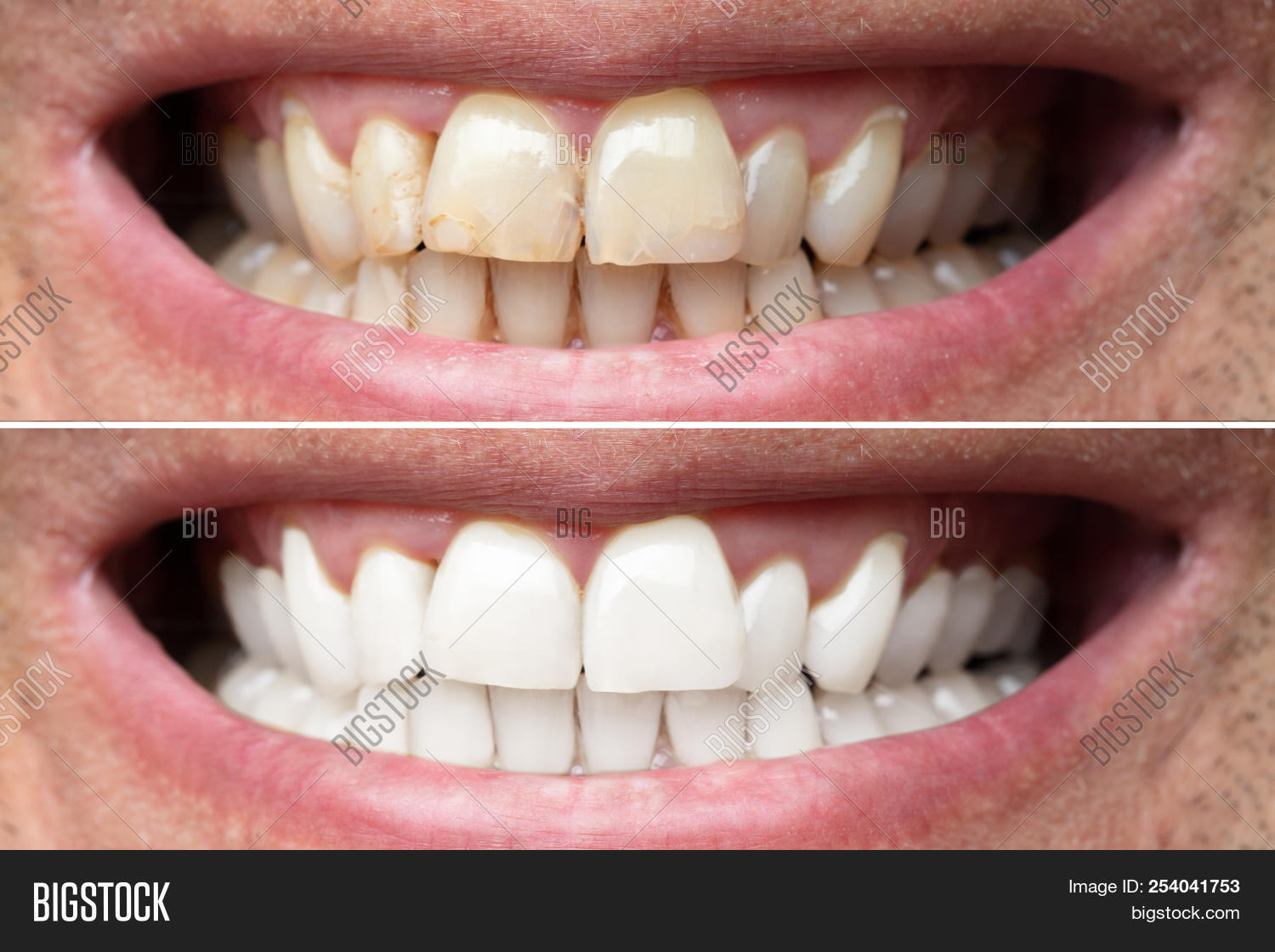 Close- Smiling Man Image & Photo (Free Trial) | Bigstock